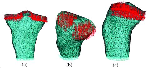 The 3d Finite Element Model Of Proximal Tibia A Front View B Top Download Scientific