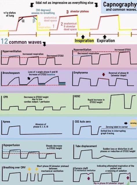 ACLS Ideas Acls Pocket Cards Pharmacology Nursing