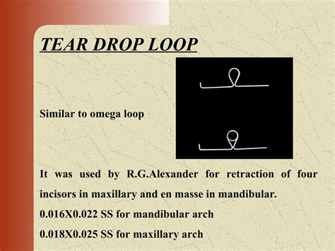 Loops In Orthodontics And Its Uses Autosaved Ppt