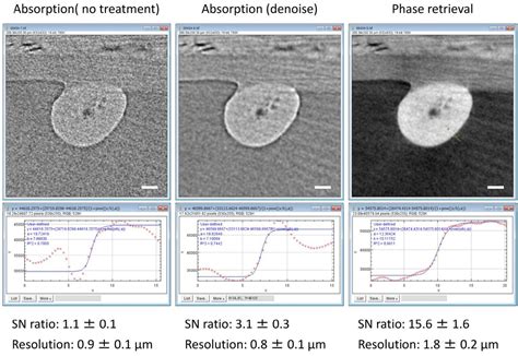 Computed Tomography Improved X Ray Imaging Using Phase Retrieval