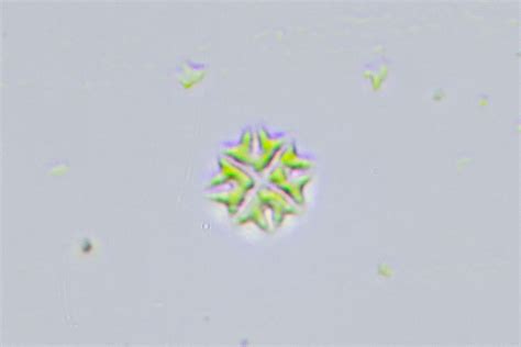Some Algae An Amoeba And A Diatom I Found Today In A Sample Of Pond Water R Microscopy