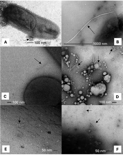 Transmission Electron Micrographs Of Vlps A D And F Virus Like