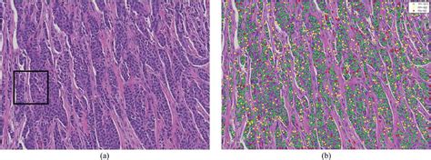 The Nuclei Detection Results B Of Ssaesmc For A Large Breast Download Scientific Diagram