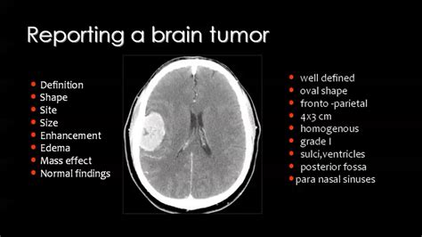 Brain Cat Scan Tumor