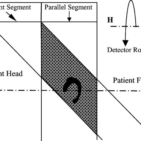 Pdf Hybrid Parallel Slant Hole Collimators For Spect Imaging