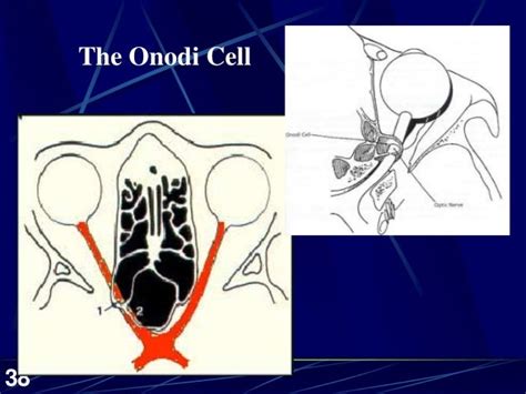 Paranasal Sinus 2002 01 Slides