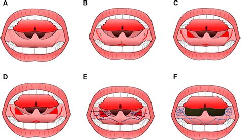 Barbed End Actin Filament Uncapping Semantic Scholar
