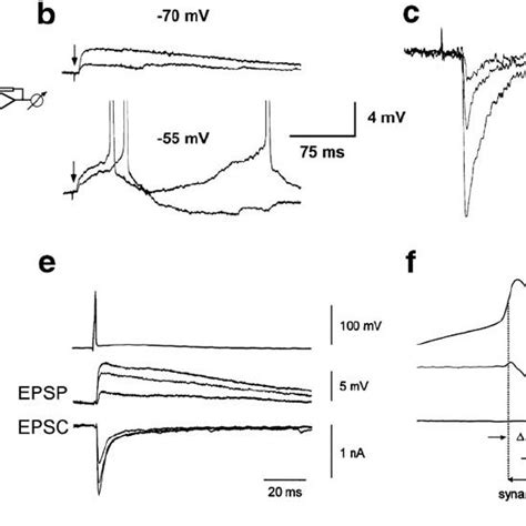 Direct Patch Clamp Recording From Hippocampal Mossy Fiber Terminals A