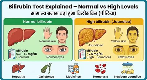 Bilirubin Test Explained Normal Range High Levels Jaundice And Liver