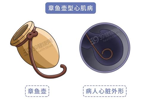 为什么失恋时心脏会感到疼痛你可能得了心碎综合征 东方养生频道 东方养生