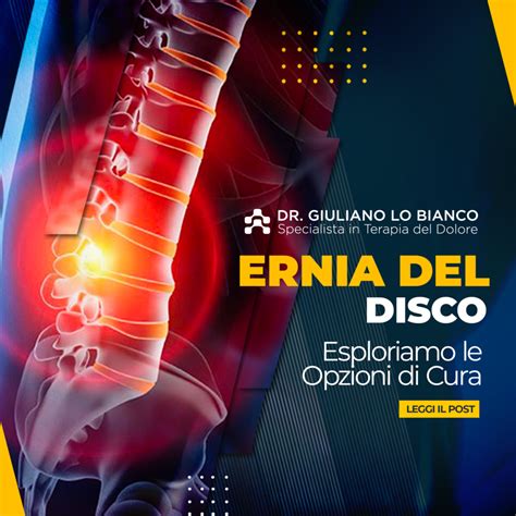 Ernia Del Disco Esploriamo Le Opzioni Di Cura Dr Giuliano Lo Bianco