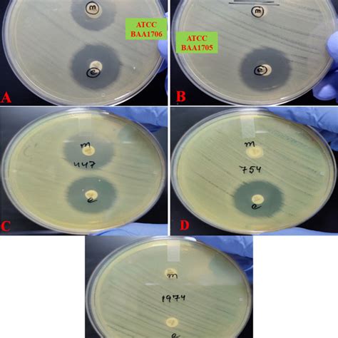 Pictorial Demonstration Of Modified Carbapenem Inactivation Method