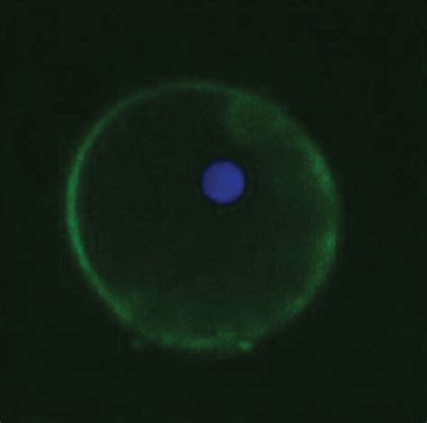 Subcellular Localization Of Lpagpl1 A Bright B Dapi C Acridine