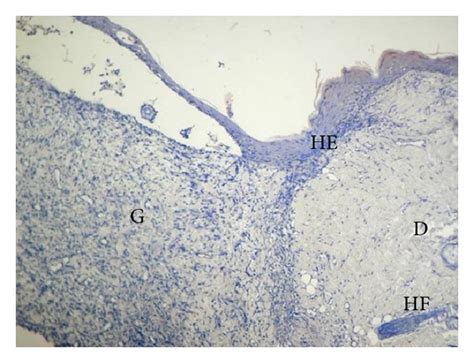 Fgf 2 Immunostaining Of The Skin Tissues Healthy Group A Control Download Scientific