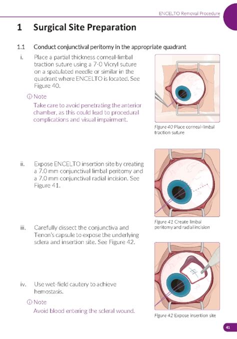 Encelto Package Insert Prescribing Information Moa