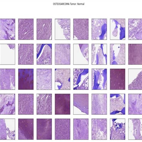 Auc For Normal And Viable Tumor Download Scientific Diagram