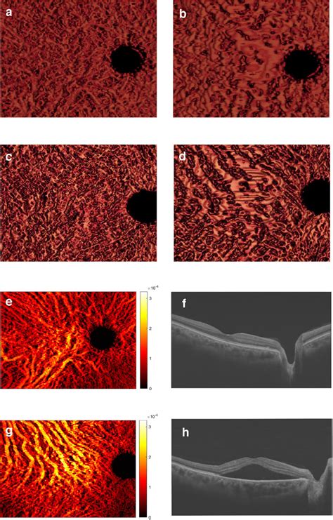 Visualization Of Choroidal Vessel Structure By Deeplearning Oct Download Scientific Diagram