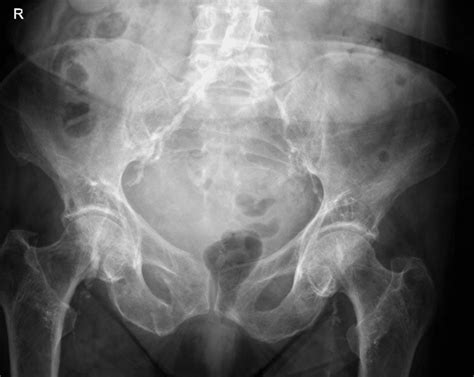 CT Case LITFL CT Scan Interpretation