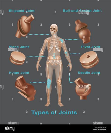 Joint Replacements In The Human Body Types Of Joint Replacements