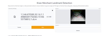 Dataframe Support From Files · Issue 945 · Gradio Appgradio · Github