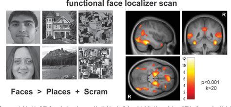 Figure 1 From White Matter Connectivity Between Face Responsive Regions