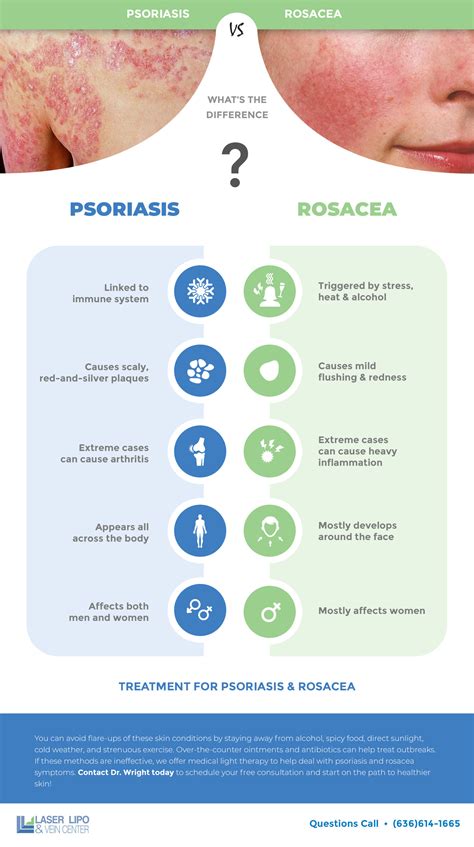 How To Get Rid Of Psoriasis Rosacea At Don Kimber Blog
