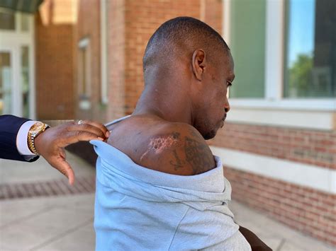 Force Disproportionately Used On Black Residents Fairfax Naacp