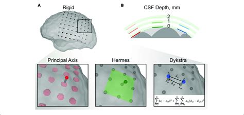 Electrode Localization Methodology A An Example Of Each Electrode Download Scientific