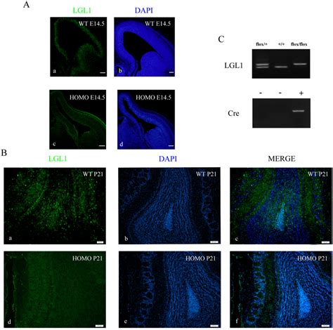 Generation Of Lgl1 Conditional Knockout Mice Mediated By Pax2 Cre