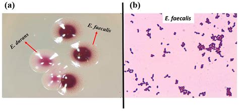 Enterococcus Microscopy Enterococcus Gramstain And Cell