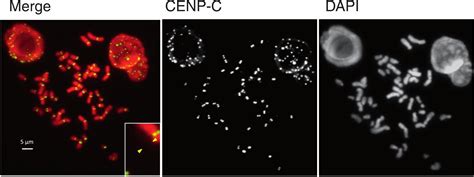 Anti Cenp C Antibody Based Immunofluorescence Dicentric Assay Radiation Dose Response