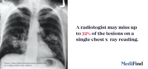 Considering A Radiology Second Opinion Practical Advice For Navigating
