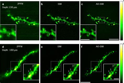 Figure 5 From Multiphoton Super Resolution Imaging Via Virtual