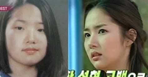 박민영 과거 성형 전후 모습에 헉
