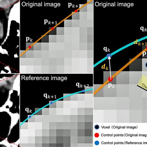 Movement Of Control Points And Voxels The Voxels In The Original Image Download Scientific