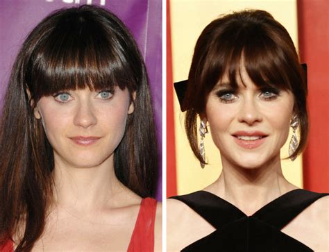 13 Celebrities Whose Faces Transformed Dramatically With Fuller Lips