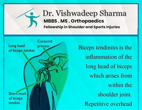 A Guide To Reverse Shoulder Replacement Surgery Delhi
