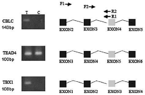 Validation Of Alternative Splicing Using A Semi Nested Pcr Assay Total