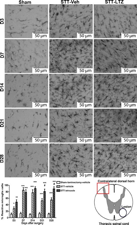 Effects Of Unilateral Lesion Of Spinothalamic Tract On Microglial