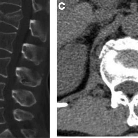 Modified Tlics Staging Scoring System Download Scientific Diagram