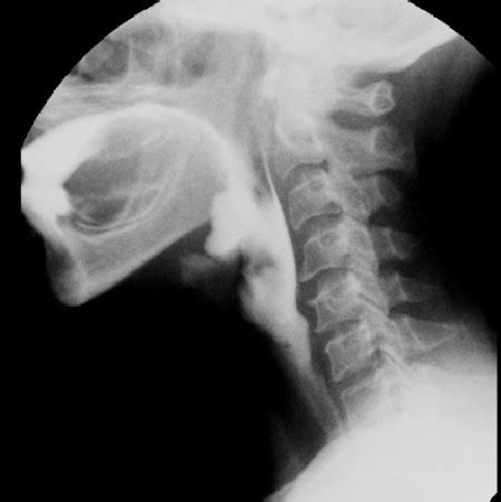Radiología Especializada Radiologo Especializados