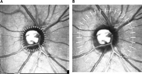 A Thirty Six Sectors Along The Contour Line Outlining The Disc