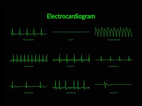تخطيط كهربائية القلب Heartae