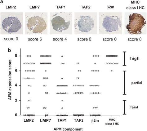 Expression Of Antigen Processing Machinery Apm Components In Acute Download Scientific