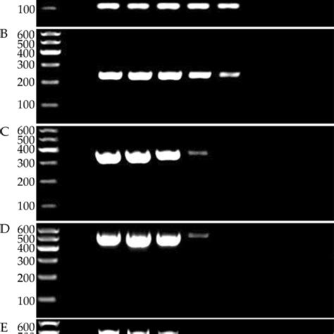 Optimization Of Annealing Temperature For Multiplex Rt Pcr Assay To