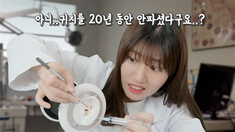 아니 귀지를 20년 동안 안파셨다구요 묵은 귀지 파주는 돌직구 의사선생님 Asmr Youtube