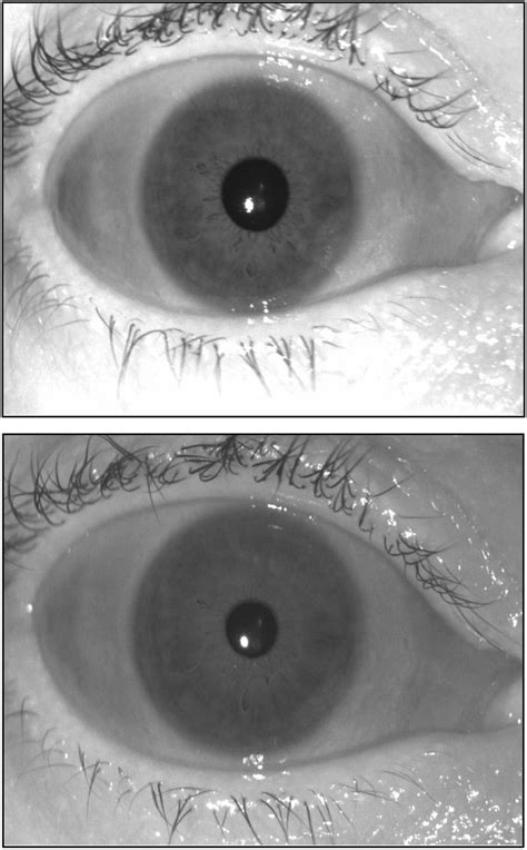 Accuracy Of Iris Recognition Systems Degrades With Increase In Elapsed Time