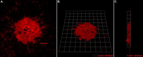 A Mouse Model For Laser Induced Choroidal Neovascularization