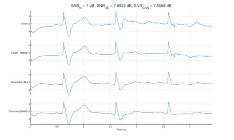 Denoise Signals With Generative Adversarial Networks Matlab