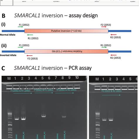 Detection And Confirmation Of Chromosome 2 Inversion Involving
